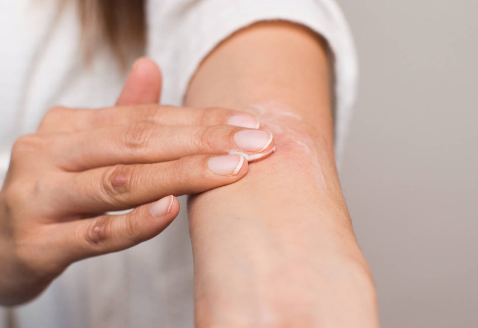 Welke zalf is goed voor smetplekken? - Santé